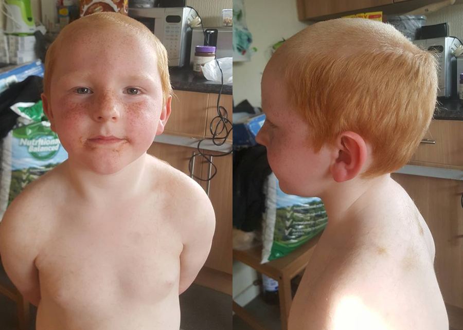 This Uncle Cut His Nephew's Hair To Look Like His Bald Neighbour