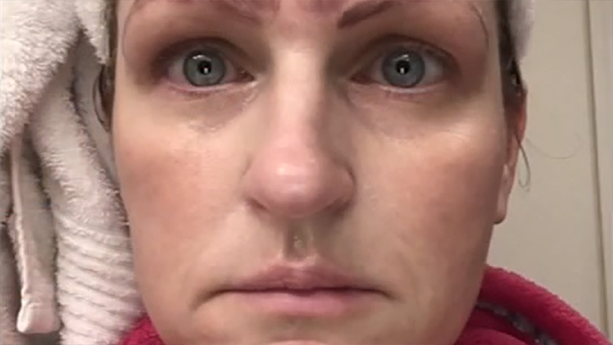 Botched microblading procedure leaves woman 'devastated' with FOUR eyebrows