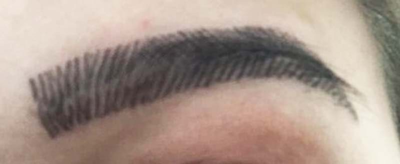 Australian woman left with STRIPEY eyebrows after botched microblading Australian woman left with STRIPEY eyebrows after botched microblading